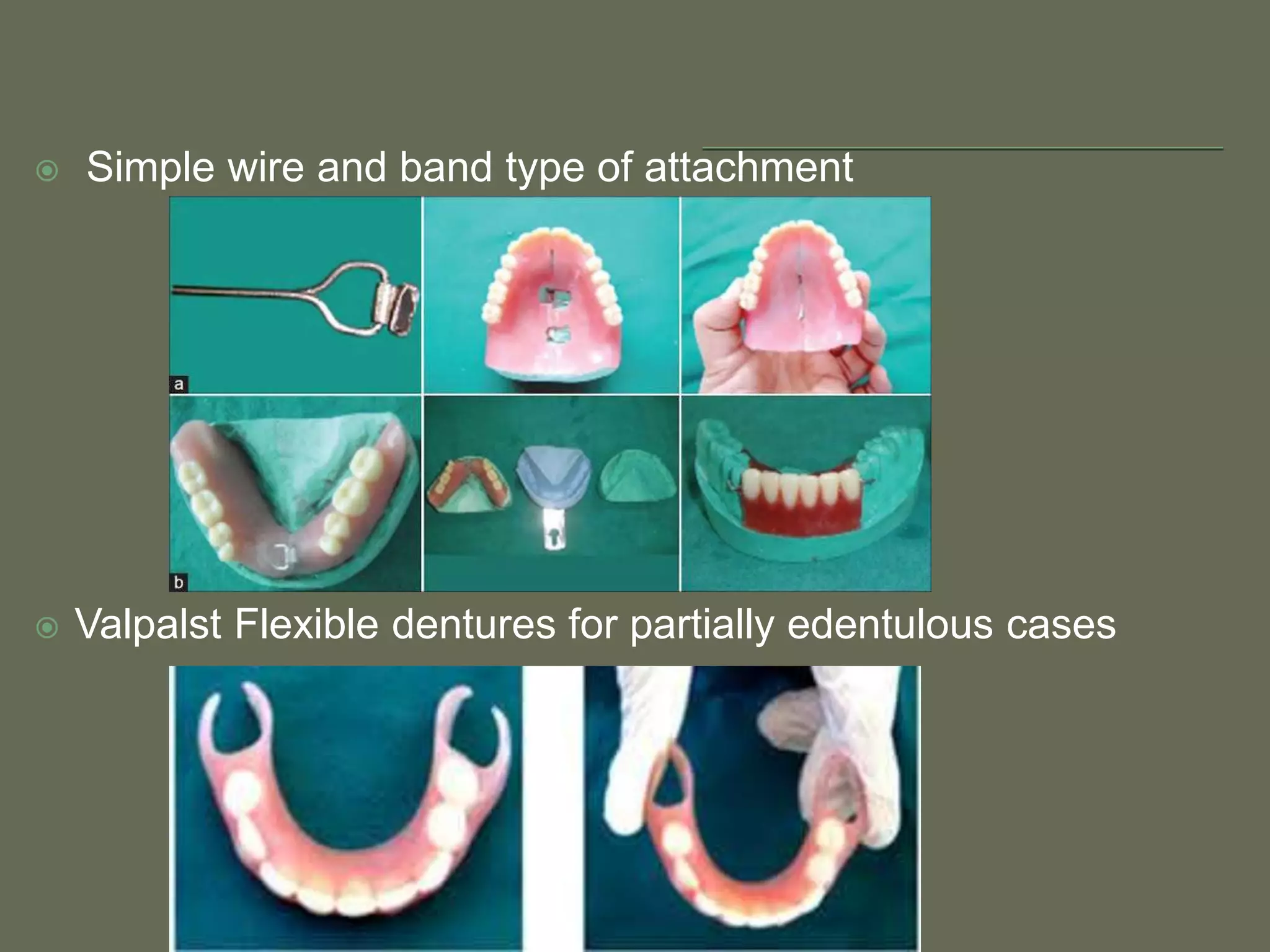 Microstomia- Prosthetic Managemnt of edentulous arches | PPTX