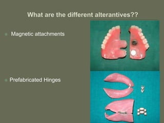 Microstomia- Prosthetic Managemnt of edentulous arches | PPTX