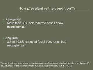 Microstomia- Prosthetic Managemnt of edentulous arches | PPTX