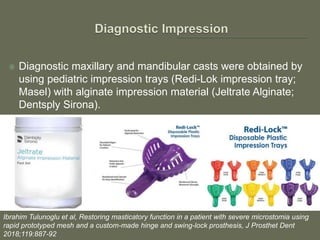Microstomia- Prosthetic Managemnt of edentulous arches | PPTX