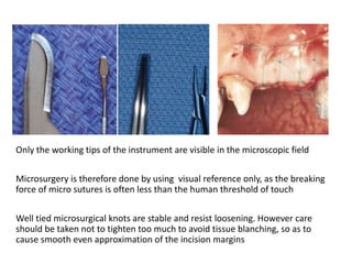 Microsurgery | PPTX