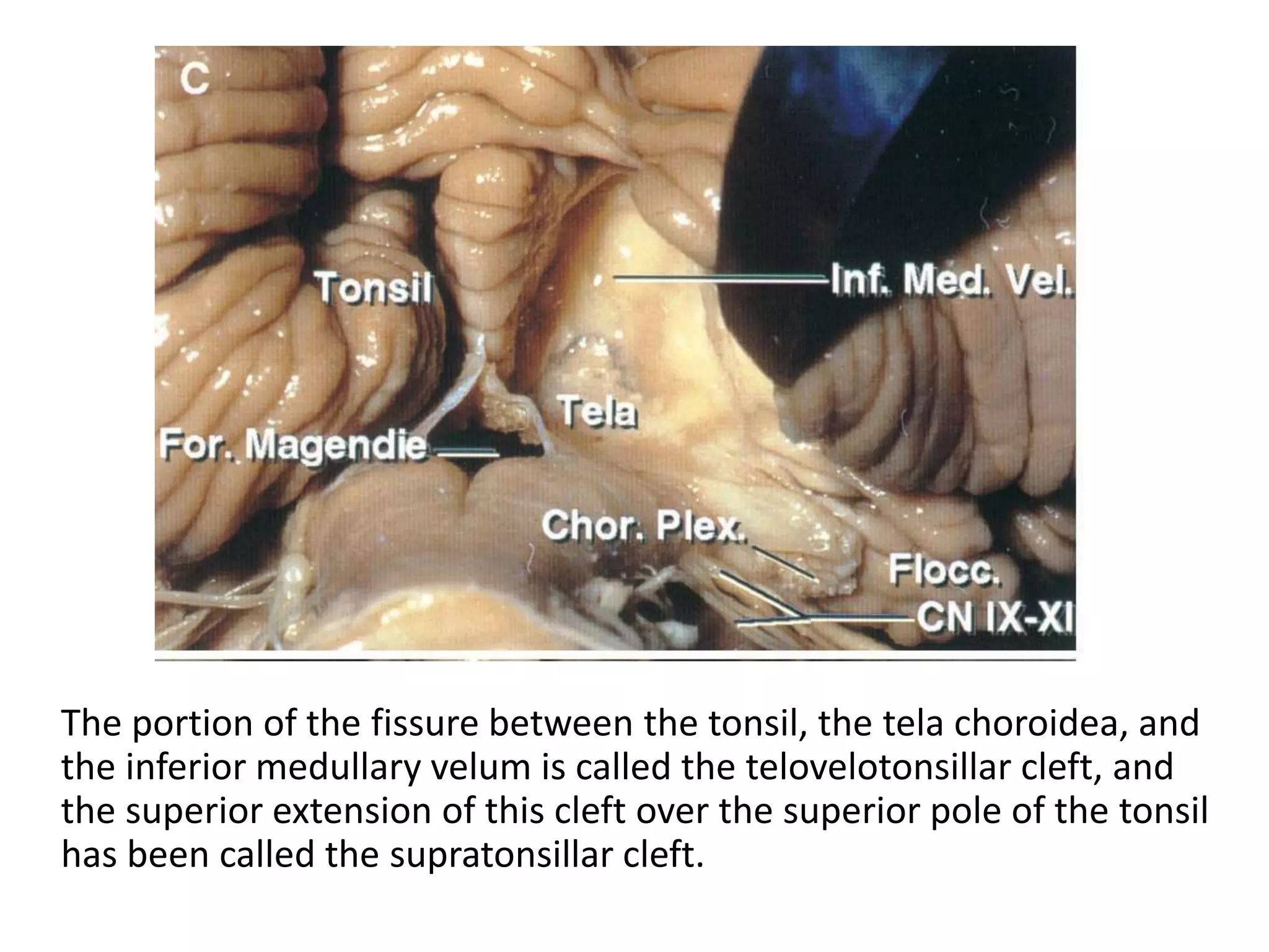 Microsurgical anatomy of fourth ventricle | PPTX