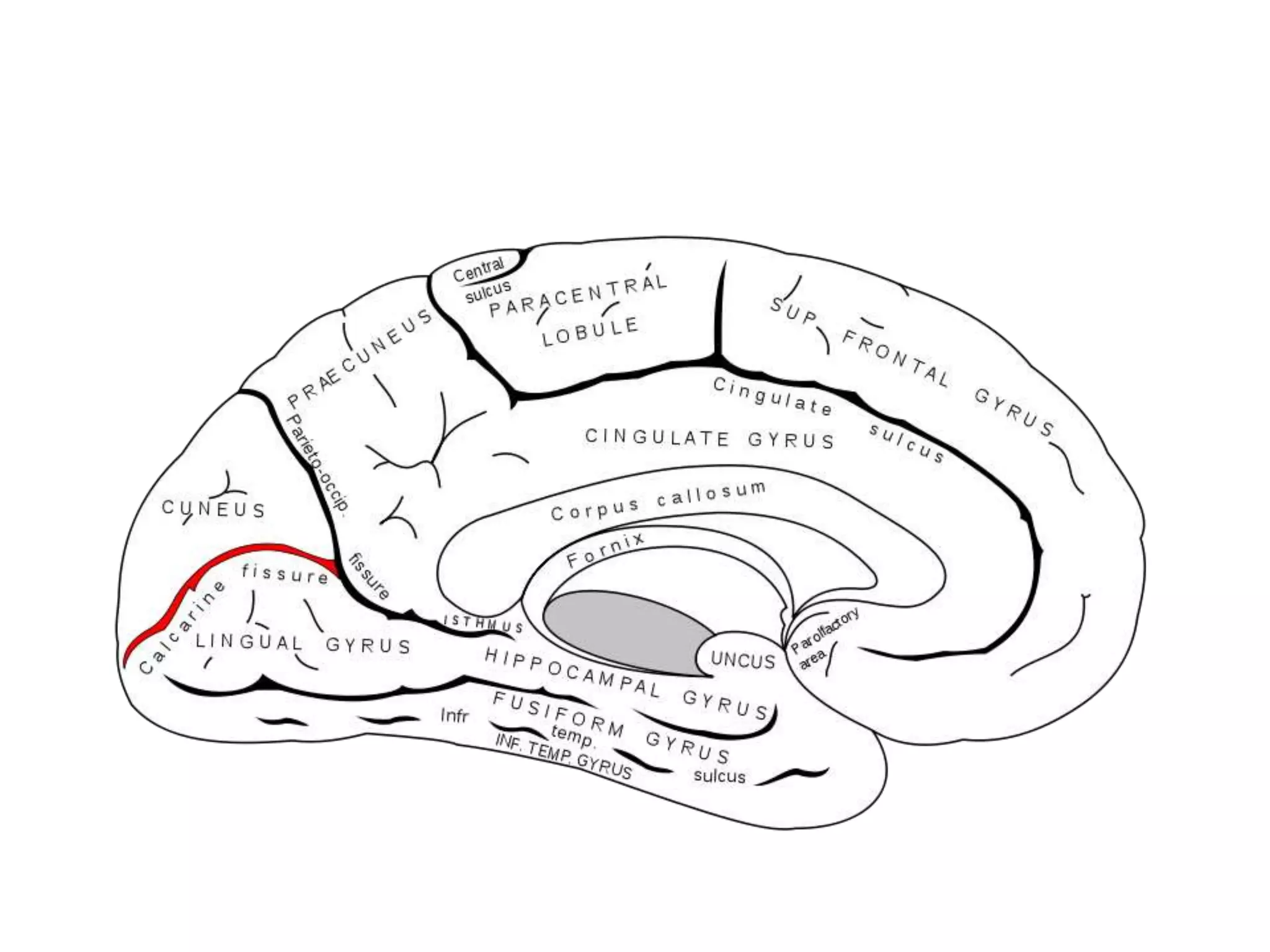Microsurgical anatomy of lateral ventricles | PPTX