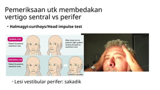 micro teaching vestibular disorder and defect on system vestibular | PPTX