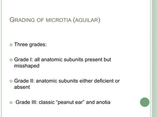 Microtia | PPTX