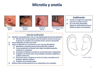 microtia.pptx