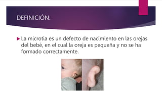 MICROTIA DIAPOSITIVAS ARIANNA LUGO OROZCO | PPTX