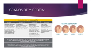 MICROTIA DIAPOSITIVAS ARIANNA LUGO OROZCO | PPTX