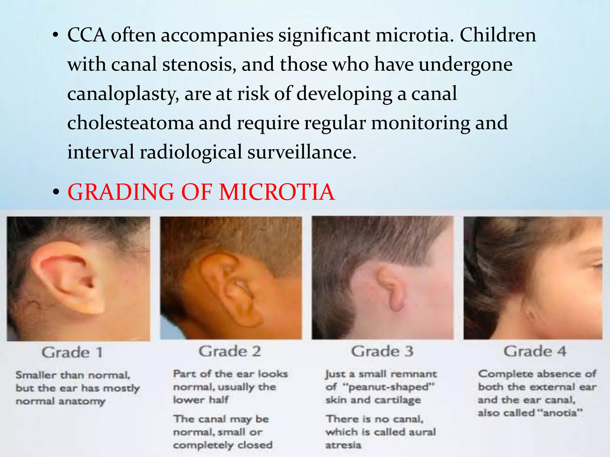 Microtia and ear abnormalities final | PPT