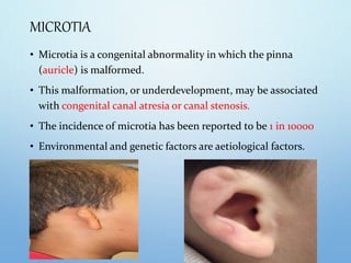 Microtia and ear abnormalities final | PPT