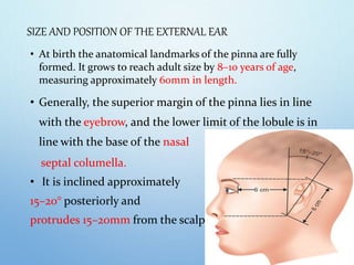 Microtia and ear abnormalities final | PPT