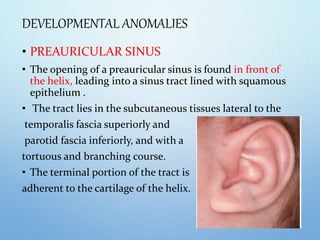 Microtia and ear abnormalities final | PPT