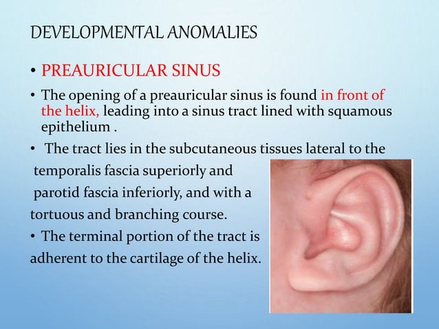 Microtia and ear abnormalities final | PPT