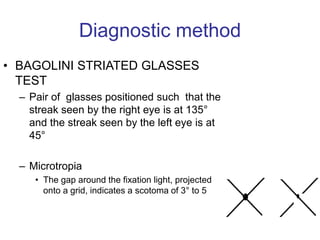 Microtropia - Definition, Types and Shot Note | PDF
