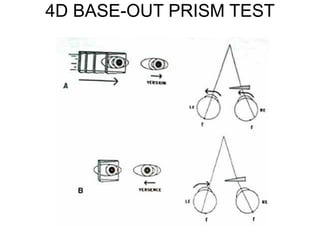 Microtropia - Definition, Types and Shot Note | PDF