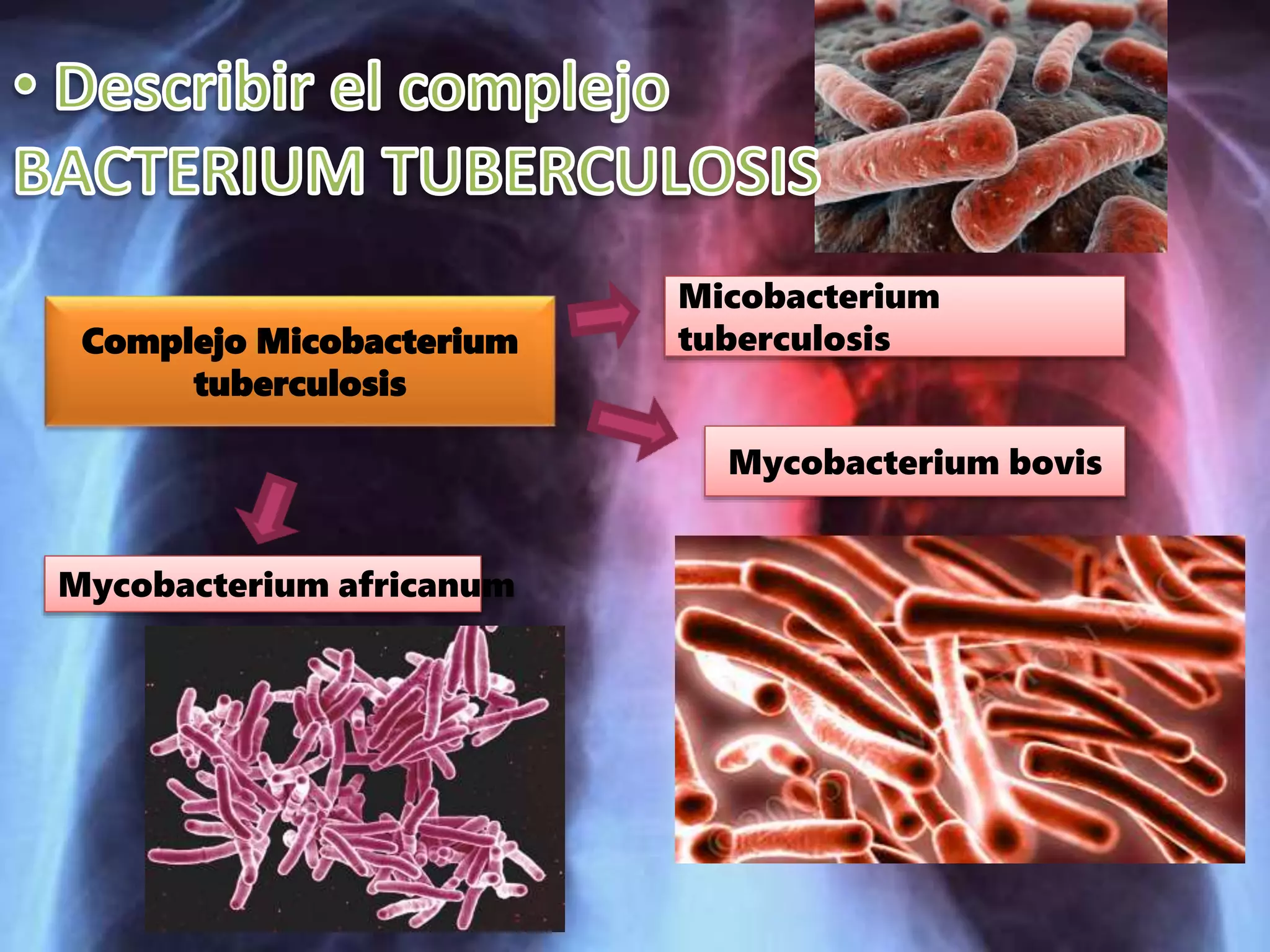 Infección por Micobacterium tuberculosis | PPT