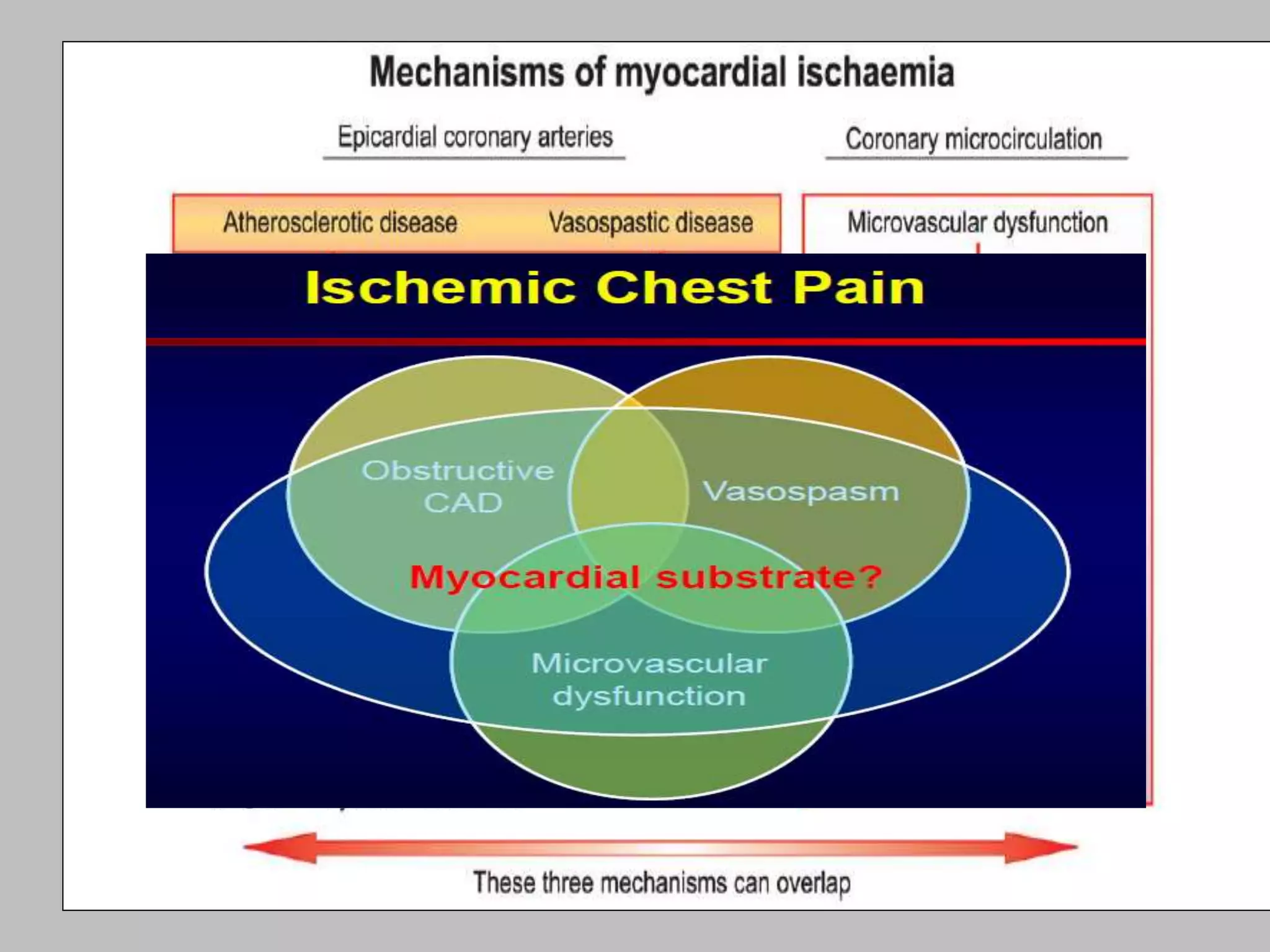 coronary microvascular dysfunction | PPTX