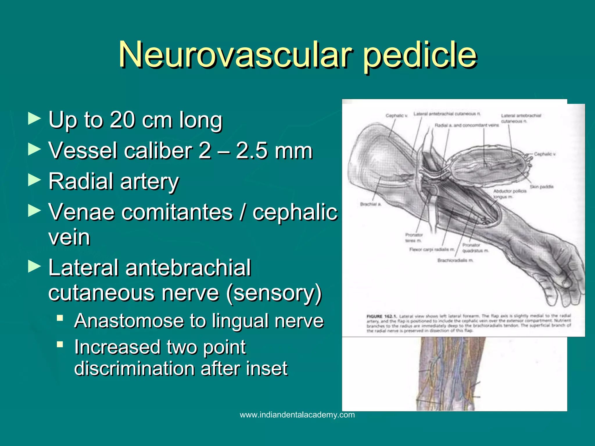 Micro vascular free flaps used in head and neck reconstruction ...