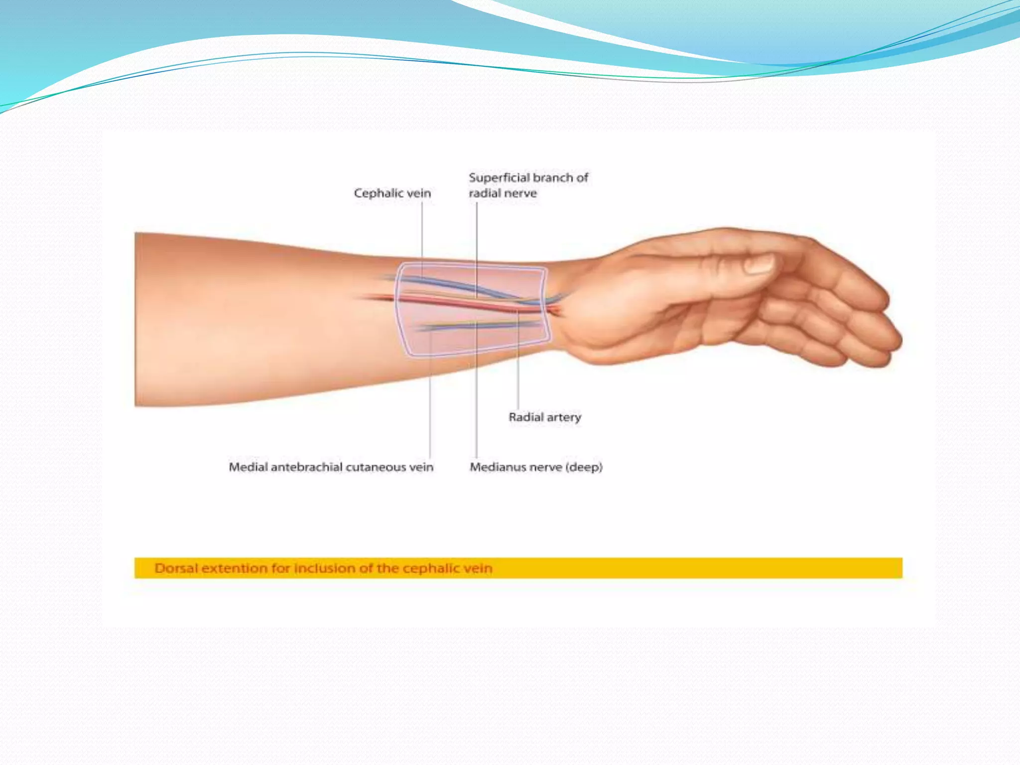 Microvascular flaps for reconstruction in head and neck cancer | PPTX