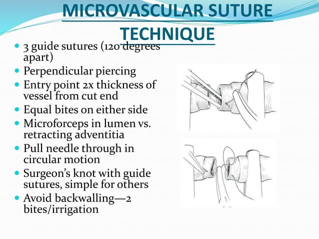 Microvascular flaps for reconstruction in head and neck cancer | PPT