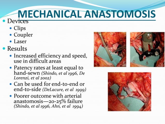 Microvascular flaps for reconstruction in head and neck cancer | PPTX ...