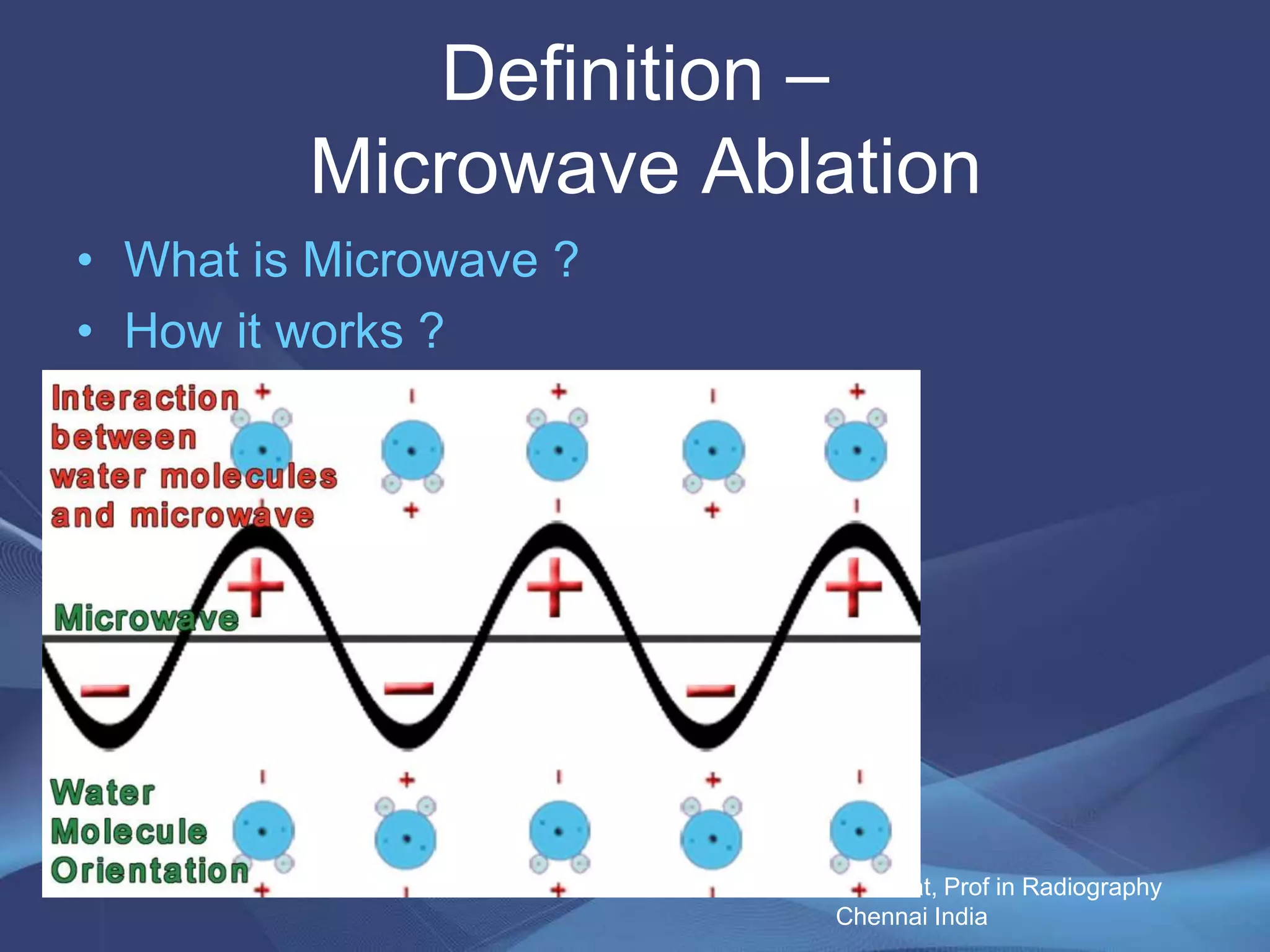 Microwave ablation by J Venkat may 2020 | PPT
