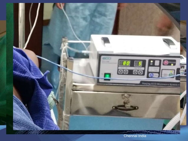 Microwave ablation by J Venkat may 2020 | PPT