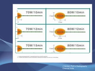 Microwave ablation by J Venkat may 2020 | PPT