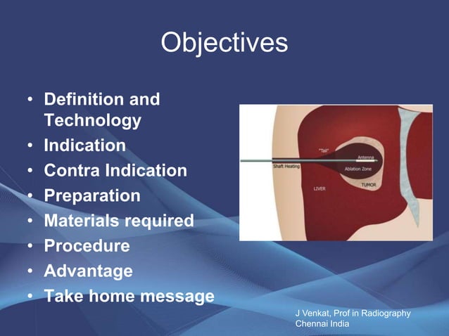 Microwave ablation by J Venkat may 2020 | PPT