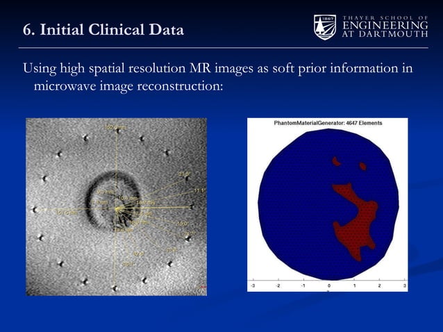 Microwave Imaging Of The Breast With Incorporated Structural