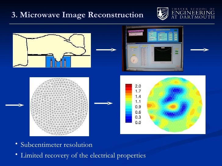 Microwave Imaging Of The Breast With Incorporated Structural Informat