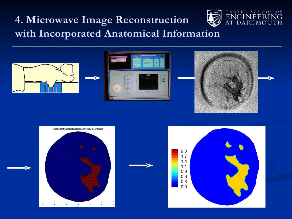 Microwave Imaging Of The Breast With Incorporated Structural Informat…