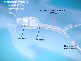Mics | PPTX | Heart and Cardiovascular Diseases | Diseases and Conditions