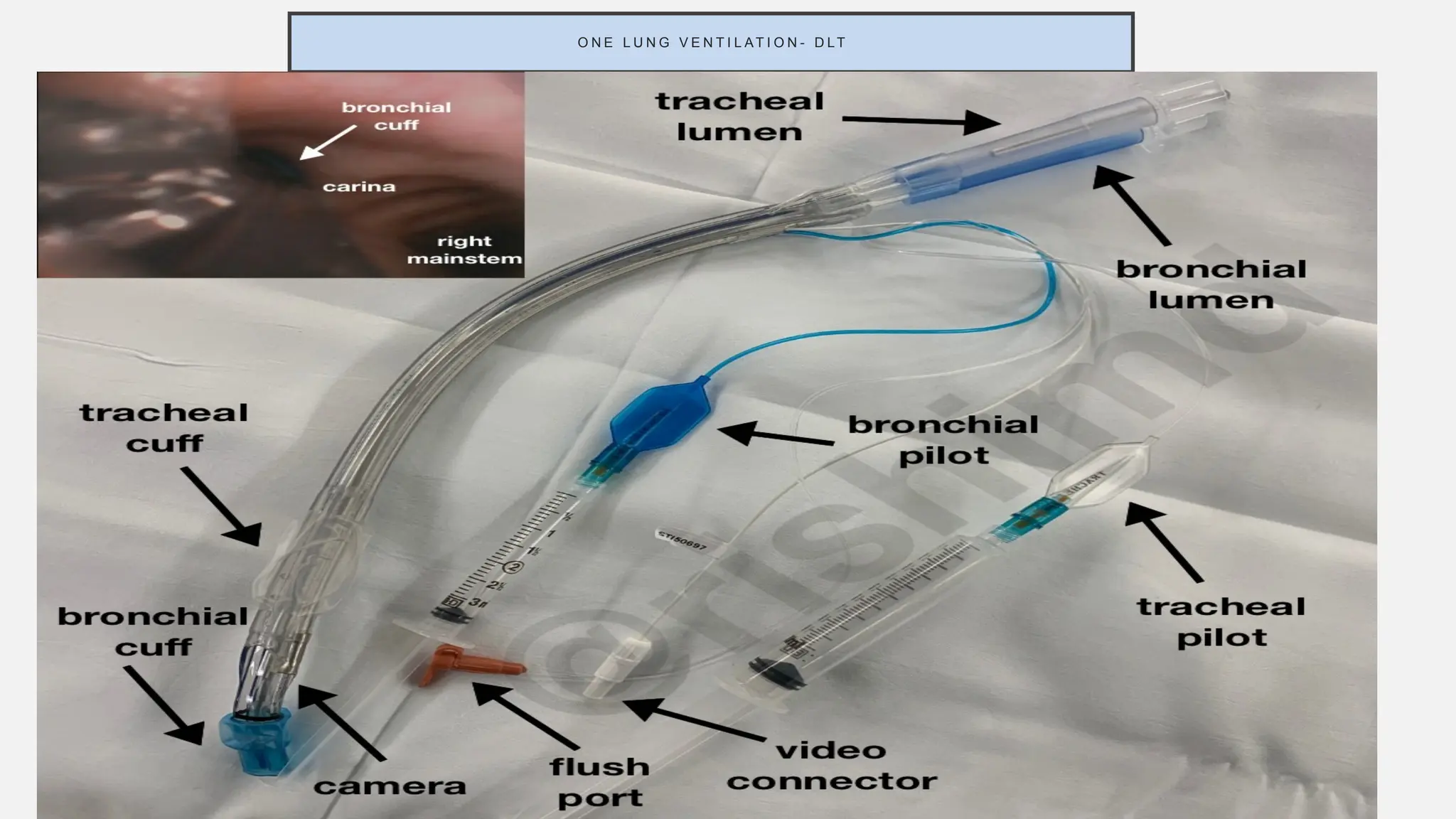 Minimal invasive cardiac surgery- Anesthesia | PPTX