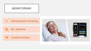 Minimal invasive cardiac surgery- Anesthesia | PPTX