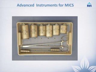 Minimally invasive cardiac surgery | PPTX