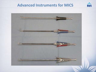 Minimally invasive cardiac surgery | PPTX