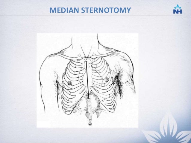 Minimally invasive cardiac surgery