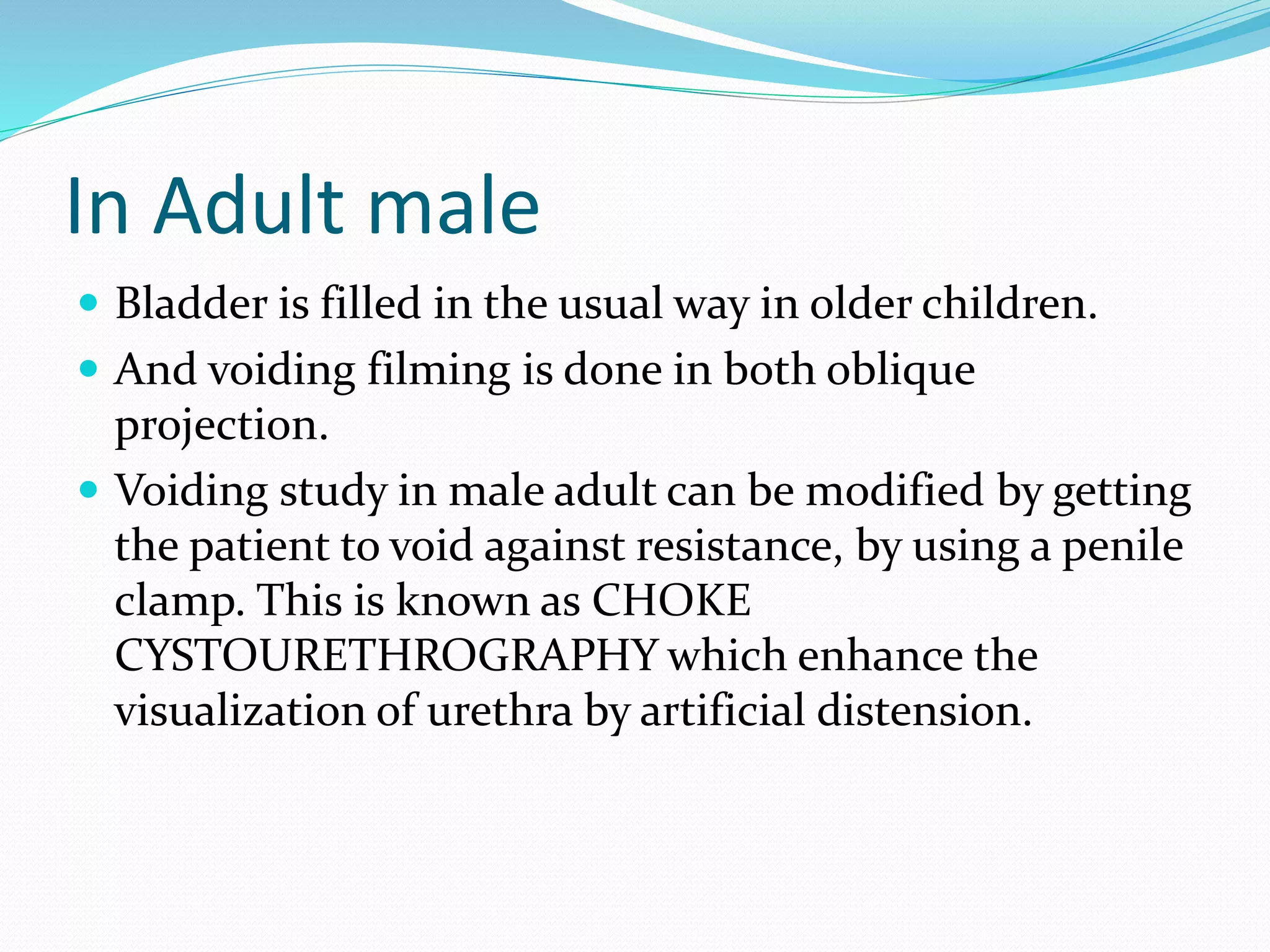 Micturating Cystourethrogram(MCU) ppt.pptx