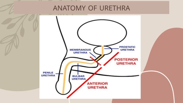MICTURATING_CYSTOURETHRORAPHY_ROOPA 30.pptx