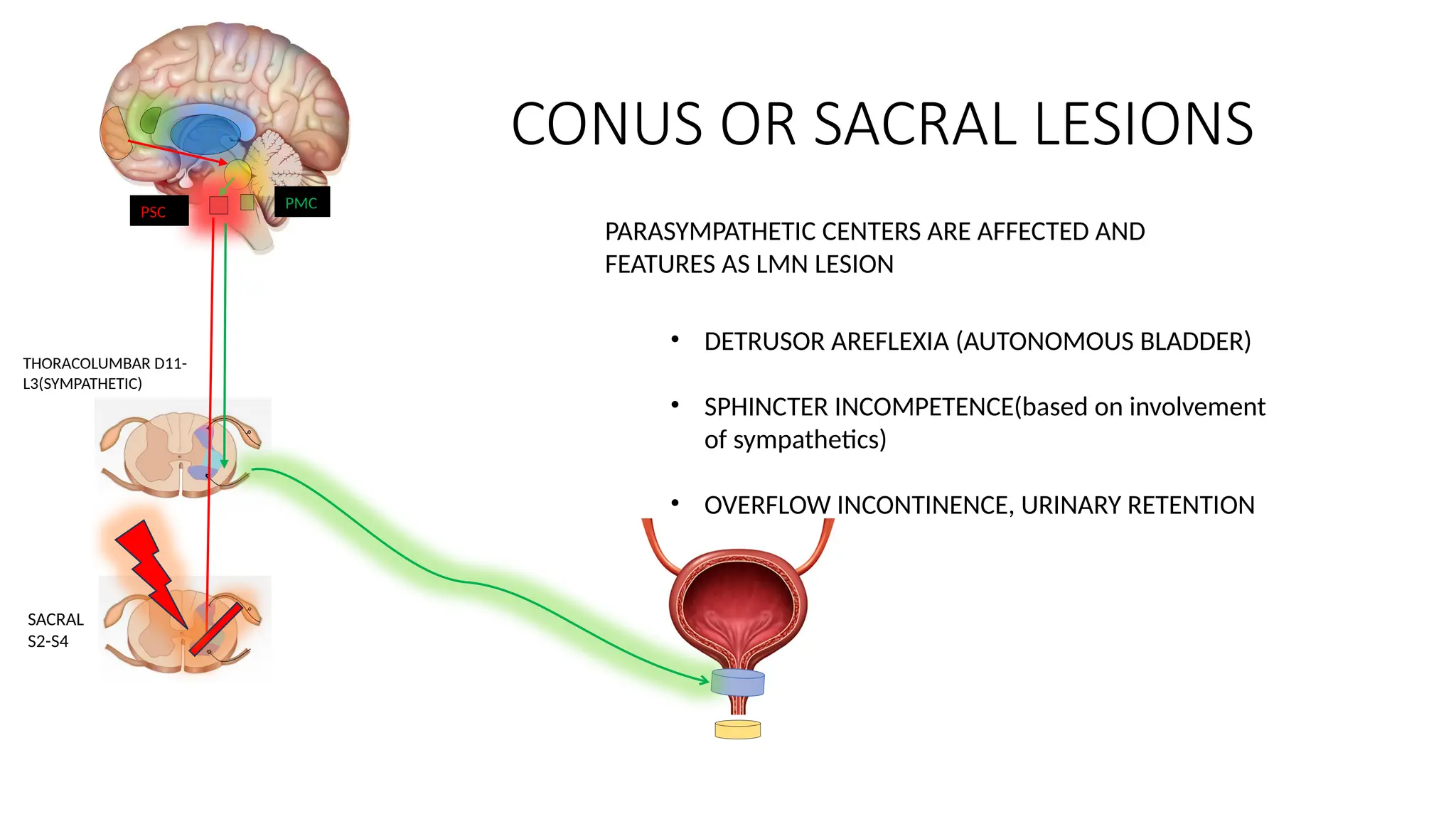 MICTURITION REFLEX -Pathophysiology Explained | PPTX