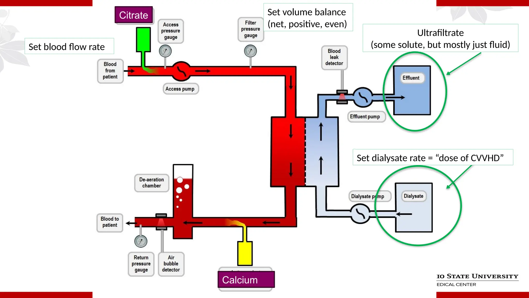 Basics of Renal Replacement Therapy (RRT) | PPT