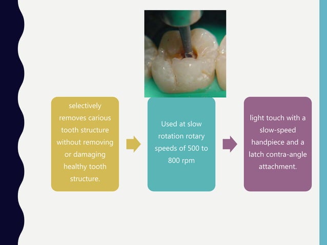 Minimally invasive dentistry | PPTX