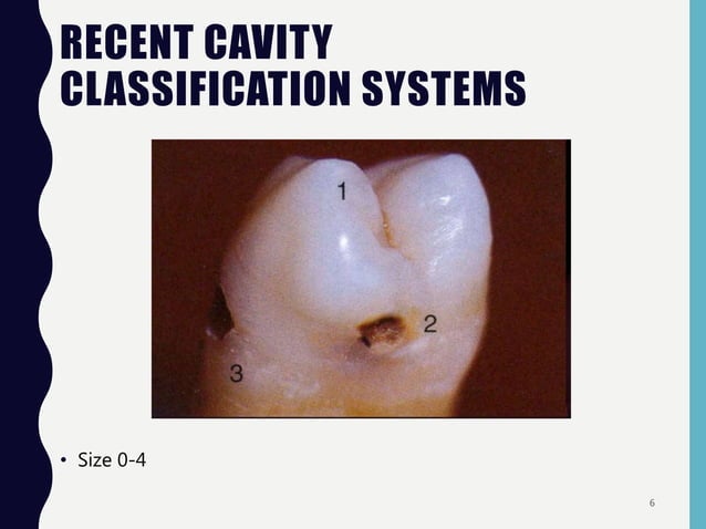 Minimally invasive dentistry | PPTX