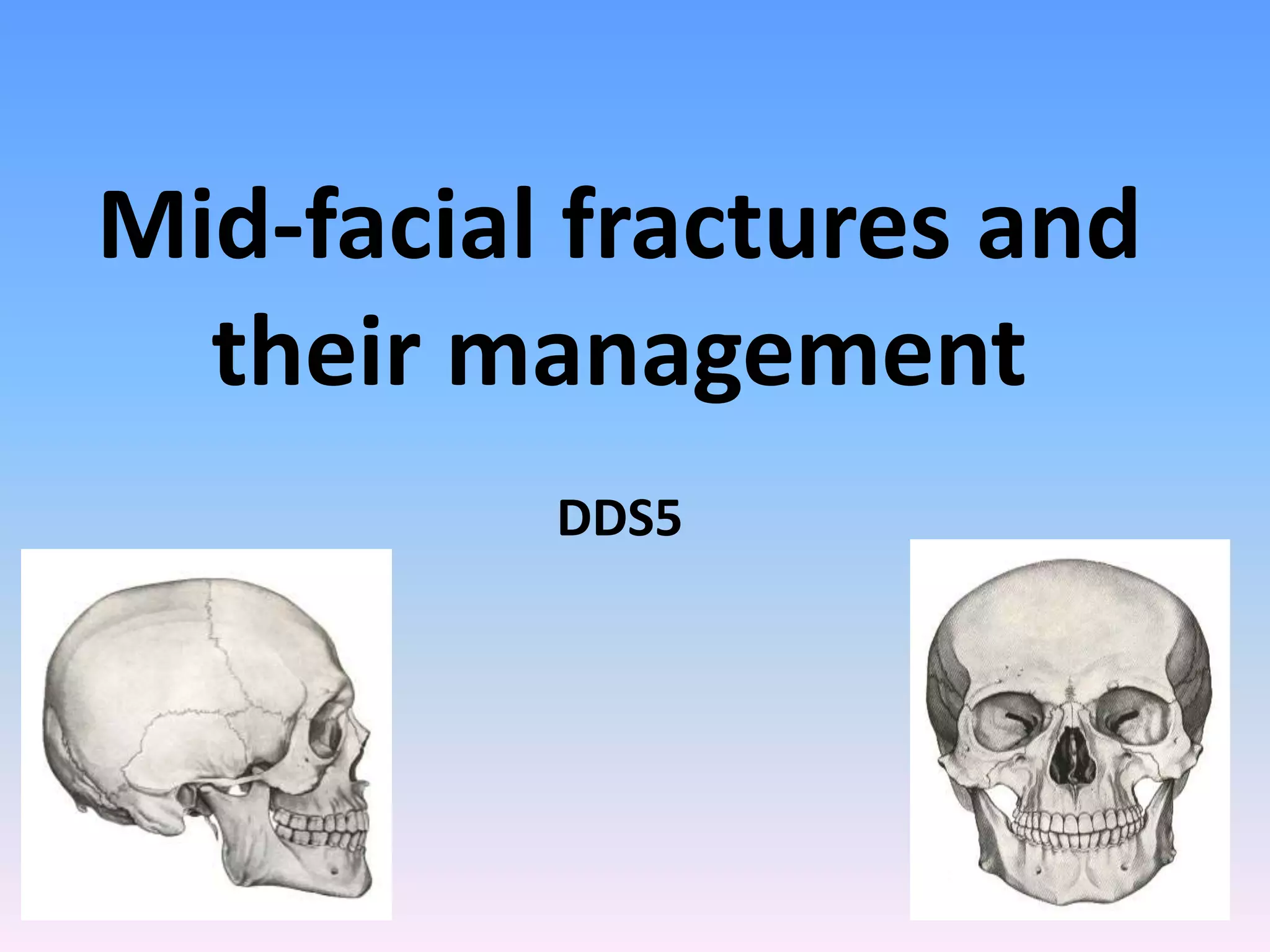 Mid facial fractures and their management | PPTX