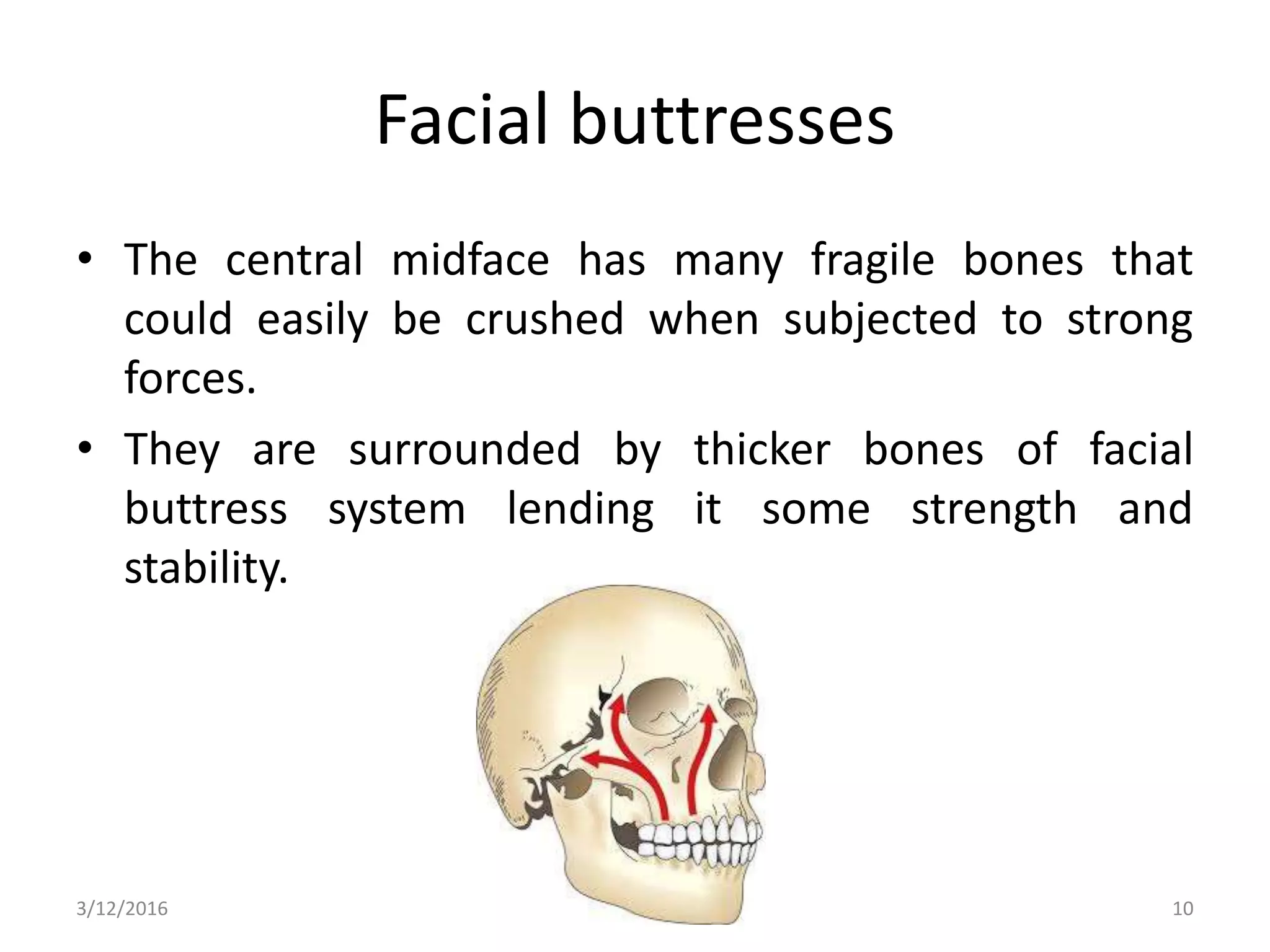 Mid facial fractures and their management | PPTX