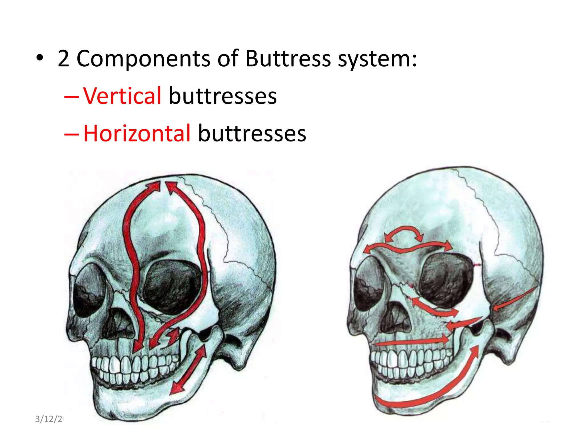 Mid facial fractures and their management | PPTX