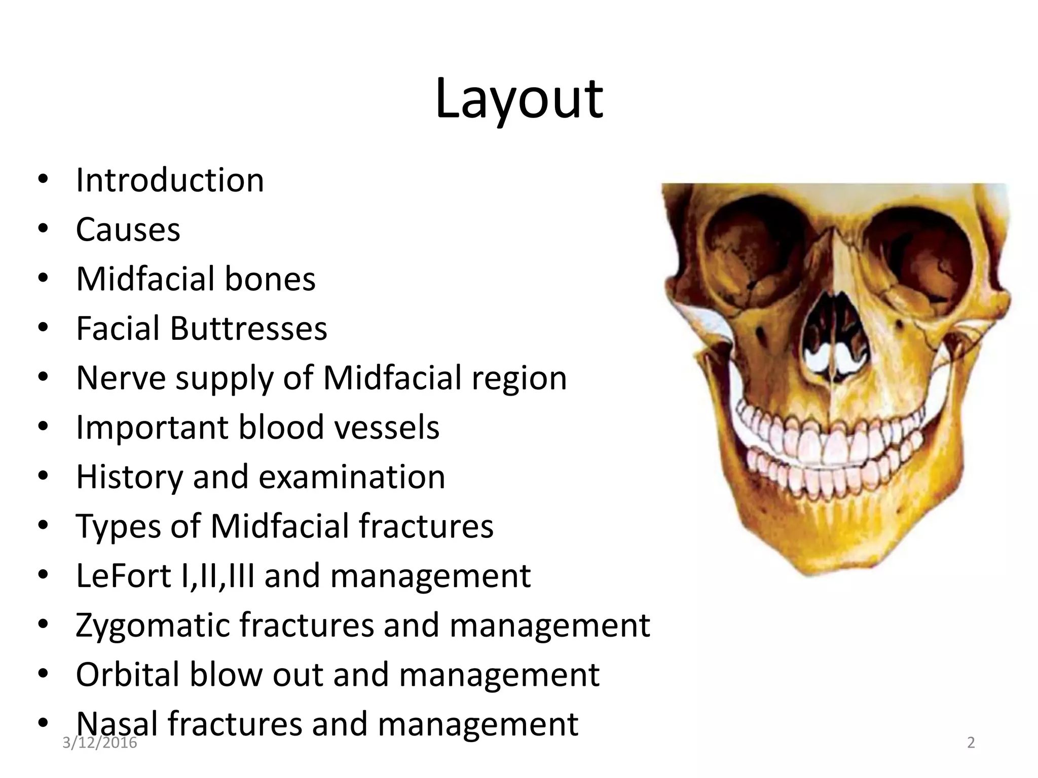 Mid facial fractures and their management | PPTX