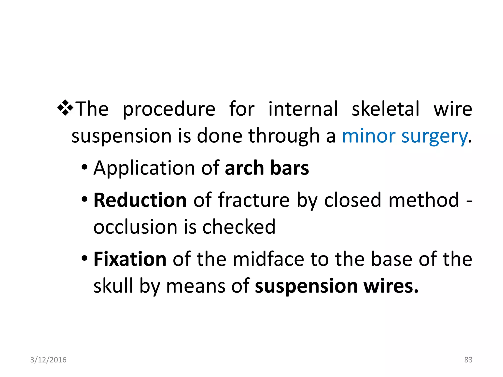 Mid facial fractures and their management | PPTX