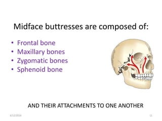 Mid facial fractures and their management | PPTX